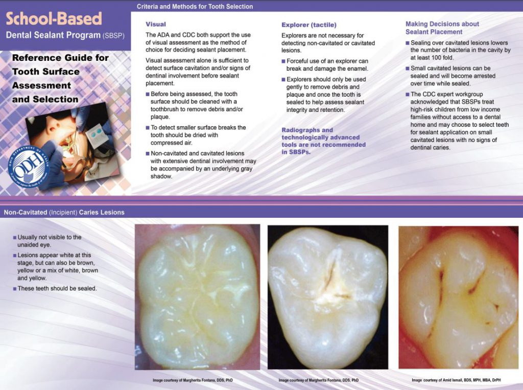 School-Based Dental Sealant Program (SBSP)